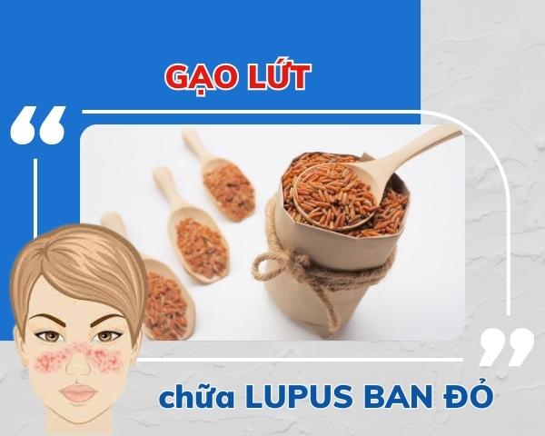 Tiết lộ 3 cách chữa lupus ban đỏ bằng Đông y cực đơn giản